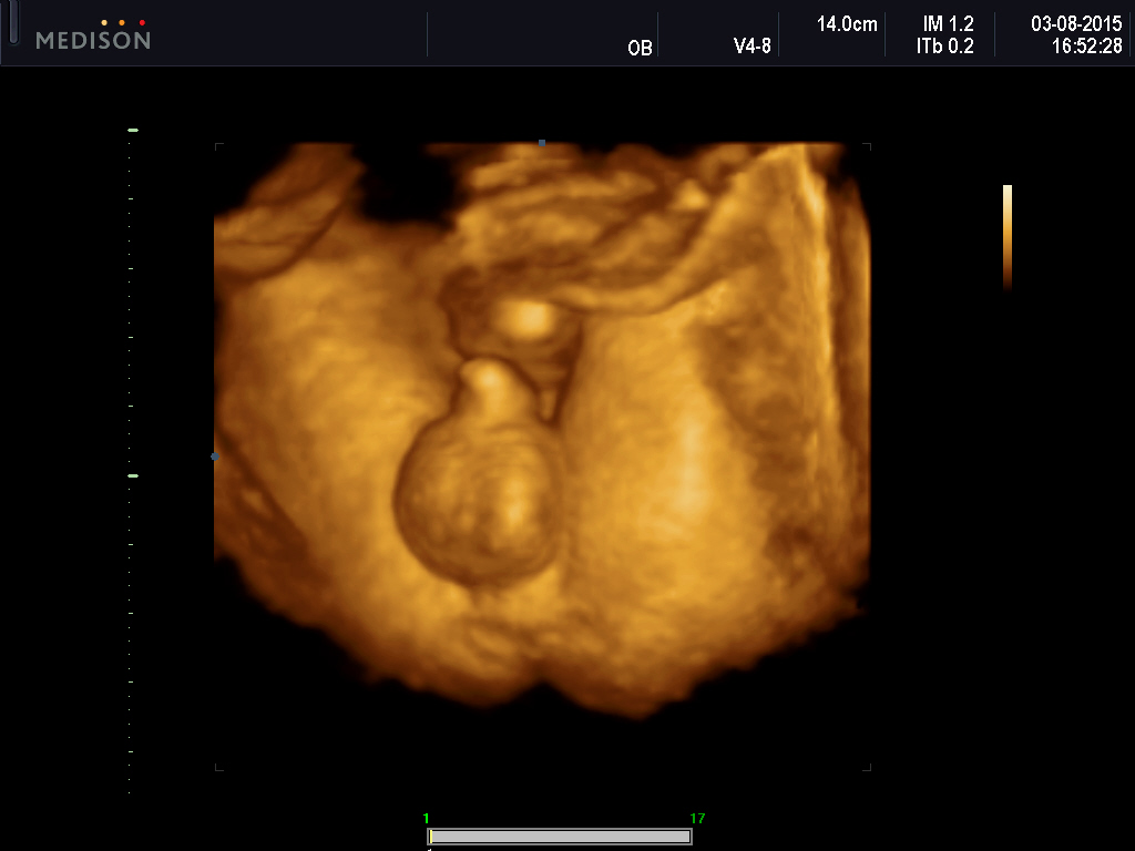 Clinica The Best 4D – Ecografias 4D Malaga y Mallorca